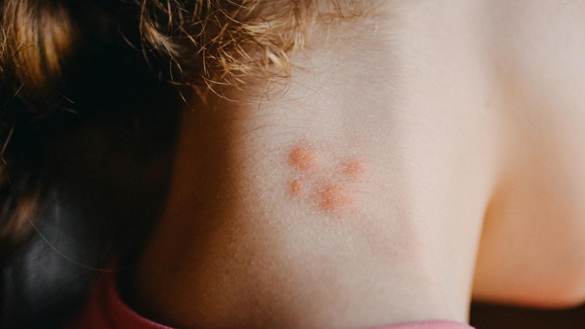 La guía visual completa para identificar al acto qué bicho típico de ...